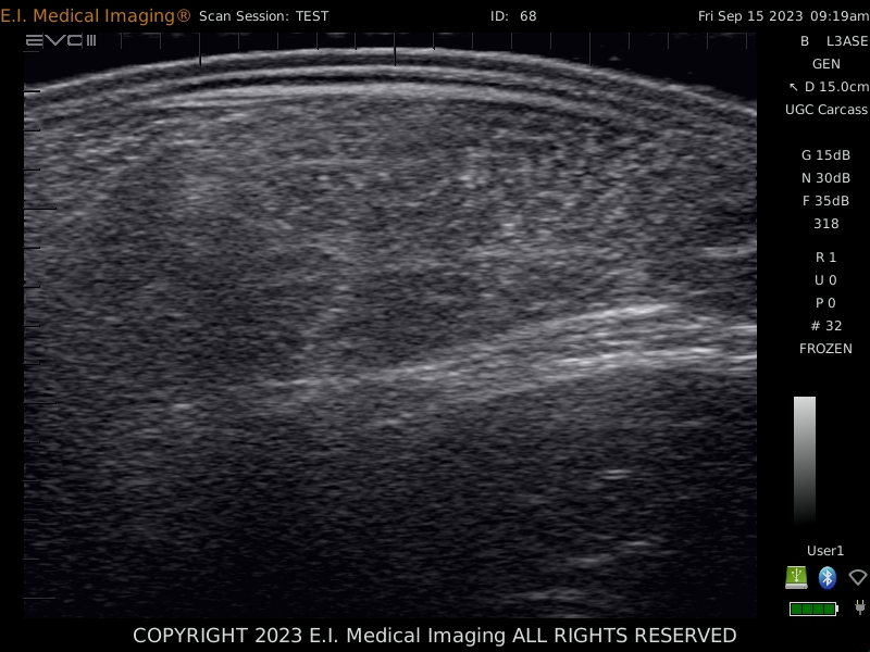 Carcass Software Instance Segmentation Dataset by Ultrasound Software