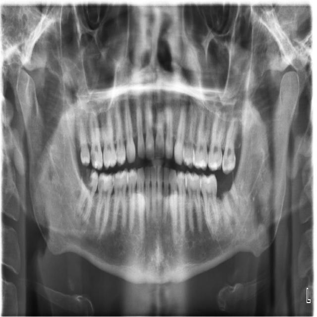 Segmentation Object Detection Dataset by 1