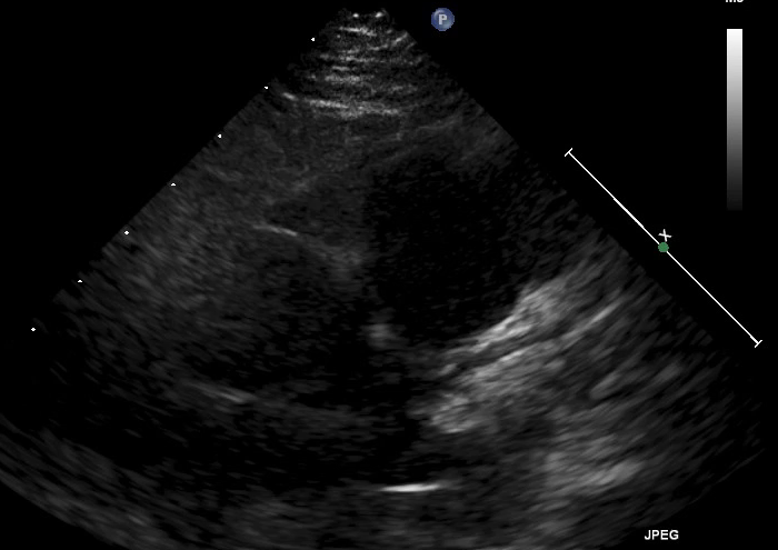 Cardiac Xray Object Detection Dataset By Tkucsie112