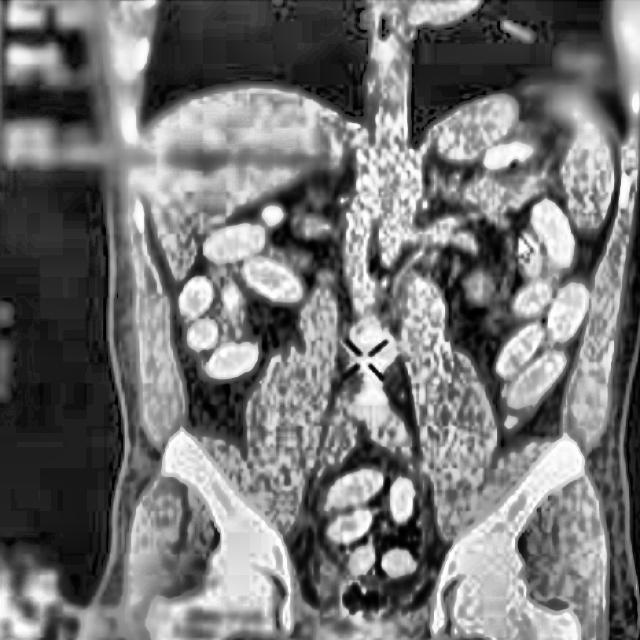 bochan - Roboflow Universe