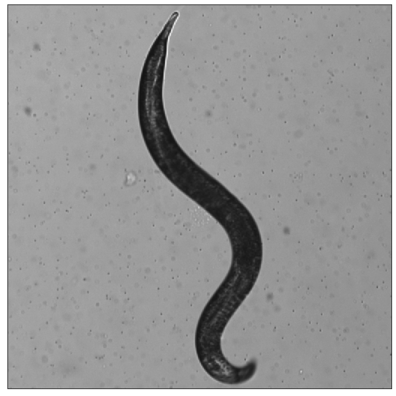 CElegans Worm Detection Object Detection Dataset and Pre-Trained Model by CElegans