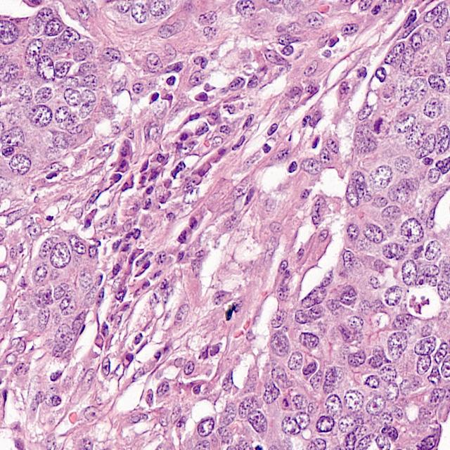 Yolov11 Object Detection Dataset And Pre Trained Model By Coco