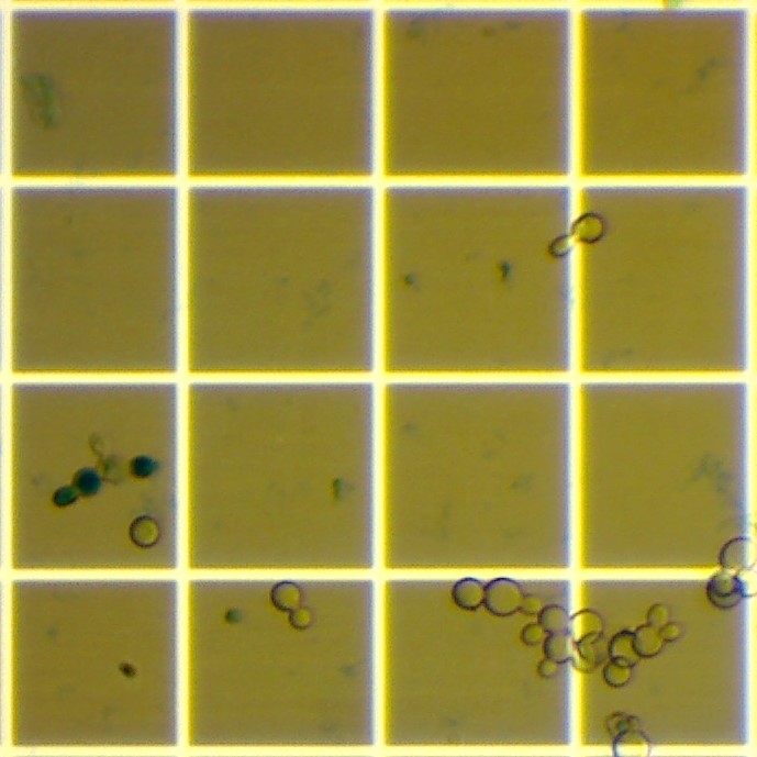 Tcc Cell Identify Count Object Detection Dataset By Tcc