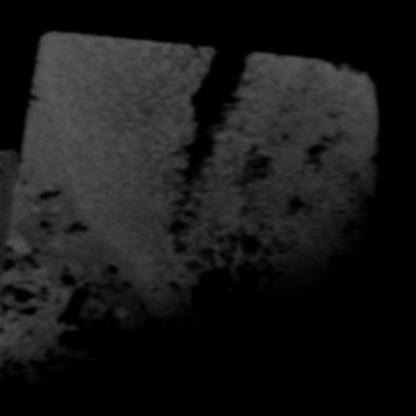 pore rcnn 2nd Instance Segmentation Dataset and Pre-Trained Model by again 2nd