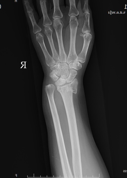 ์New Dataset segment Instance Segmentation Dataset by projectwristbone64