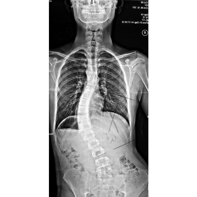 How to Use the Sconet Keypoint Detection API