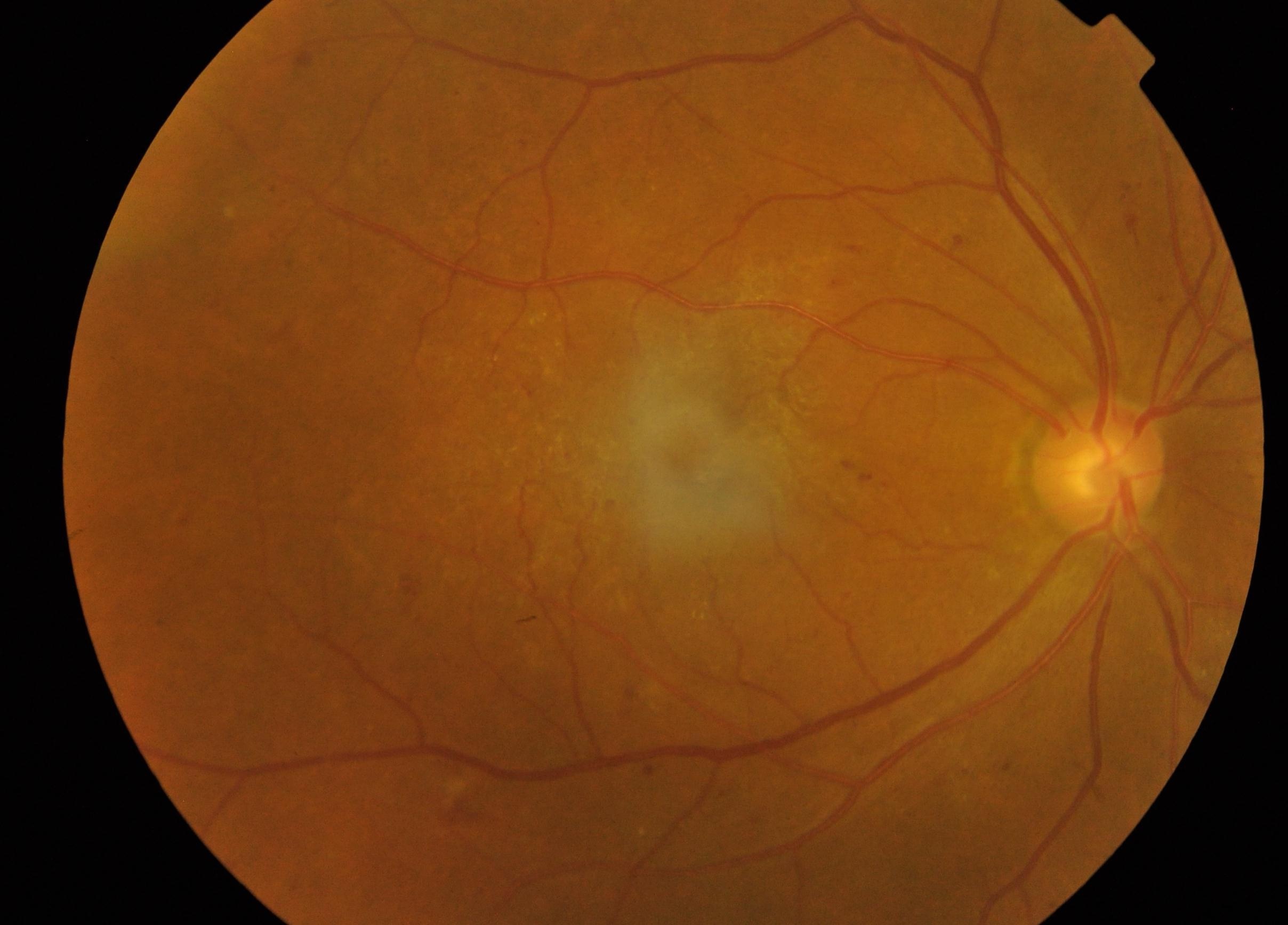 Classification (classification-tjb6v) - Roboflow Universe