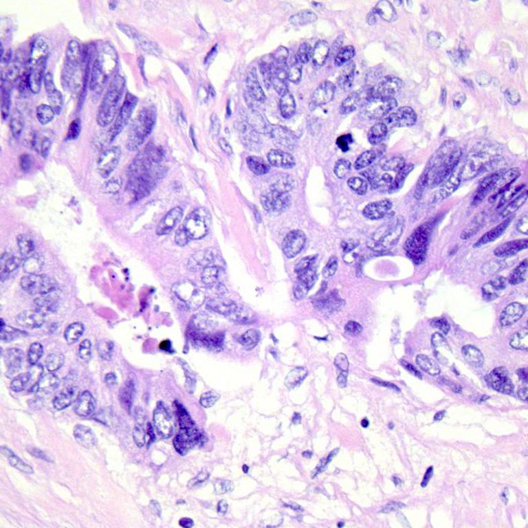 cv (cv-jtv4w) - Roboflow Universe