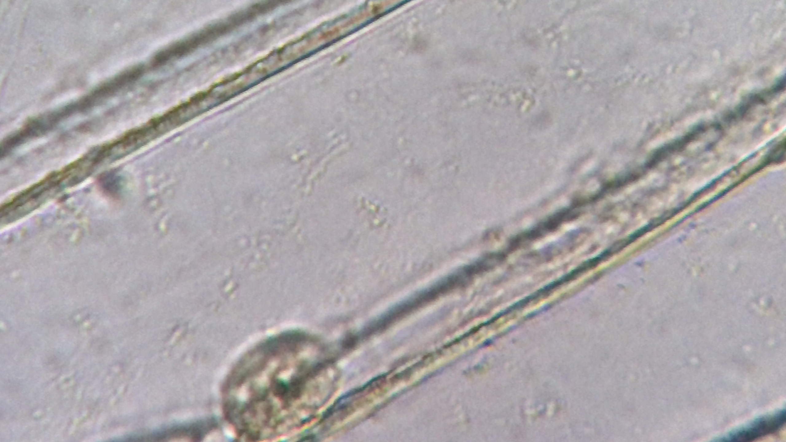 onion e-eyepiece Classification Dataset by SMT