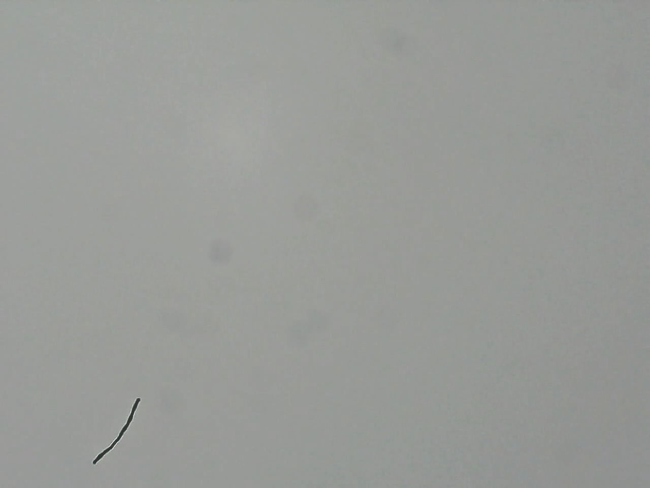 onion e-eyepiece Classification Dataset by SMT