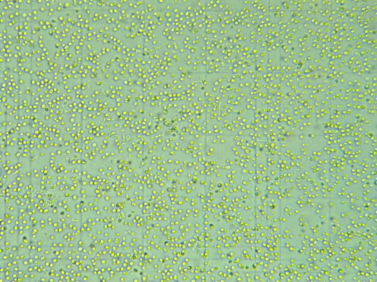 Algae Contamination Detection Object Detection Dataset by alon practice