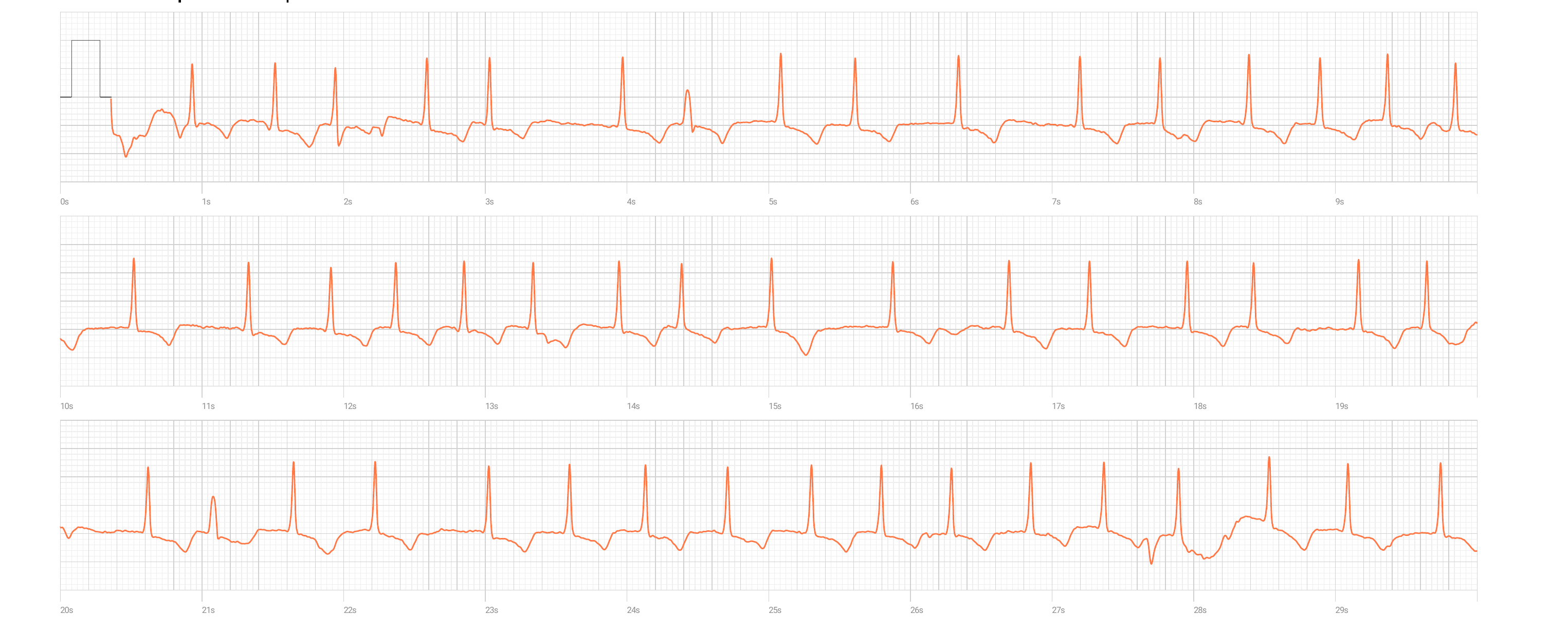 EKG-Train 2 Object Detection Dataset by Veri Etiketleme