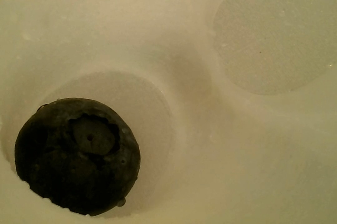 Cancer Detection Instance Segmentation Dataset and Pre-Trained Model by Moonshot Robotic Arm AI