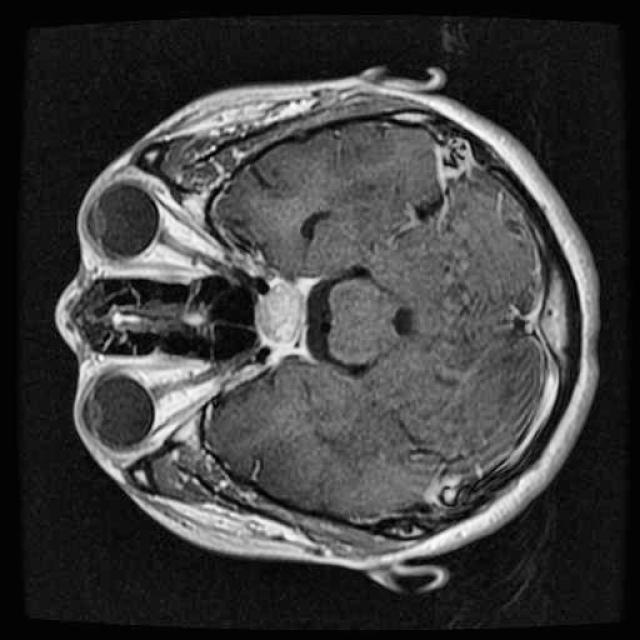 tumor Object Detection Dataset by skr