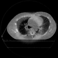 final trial - Roboflow Universe