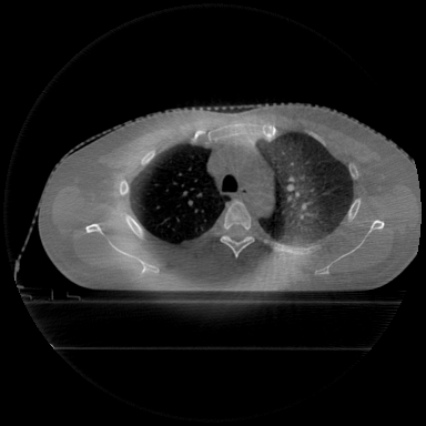 segmentation Instance Segmentation Dataset by final trial
