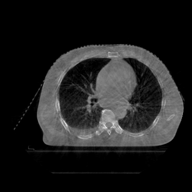 segmentasi final Instance Segmentation Dataset and Pre-Trained Model by final trial