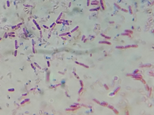 Top Ecoli Datasets And Models Roboflow Universe