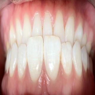 tooth Instance Segmentation Dataset and Pre-Trained Model by dental