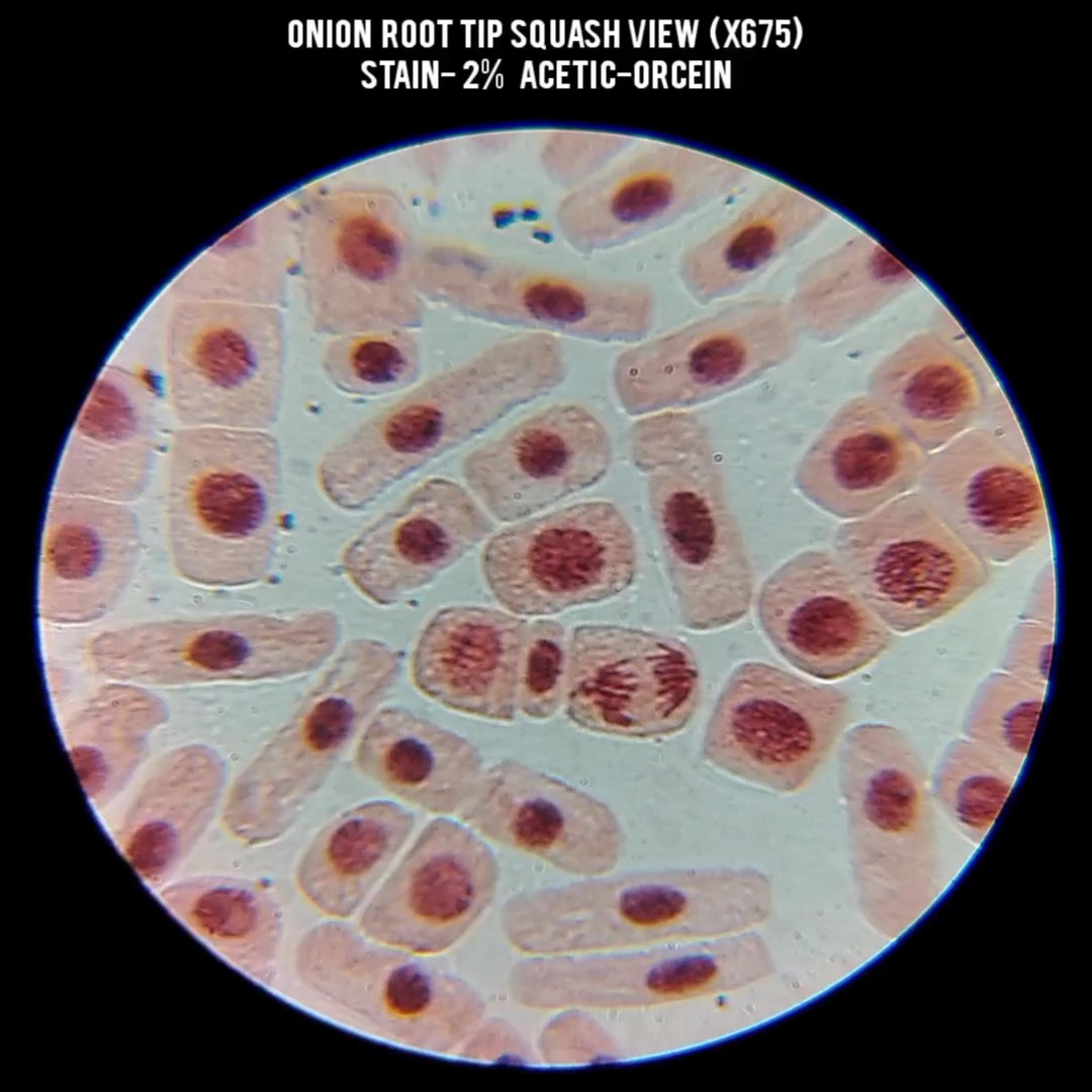 Onion-Cell-Merged-v6 Object Detection Dataset and Pre-Trained Model by CSC173 Project