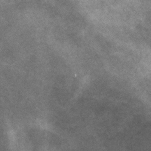 INBreast_CC_Valid Classification Dataset by Farhan Shahid