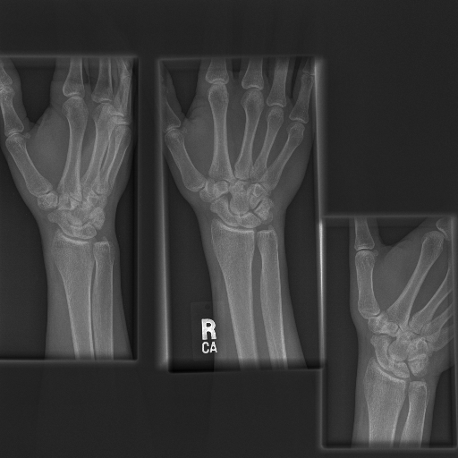x-ray Classification Dataset by Ramit