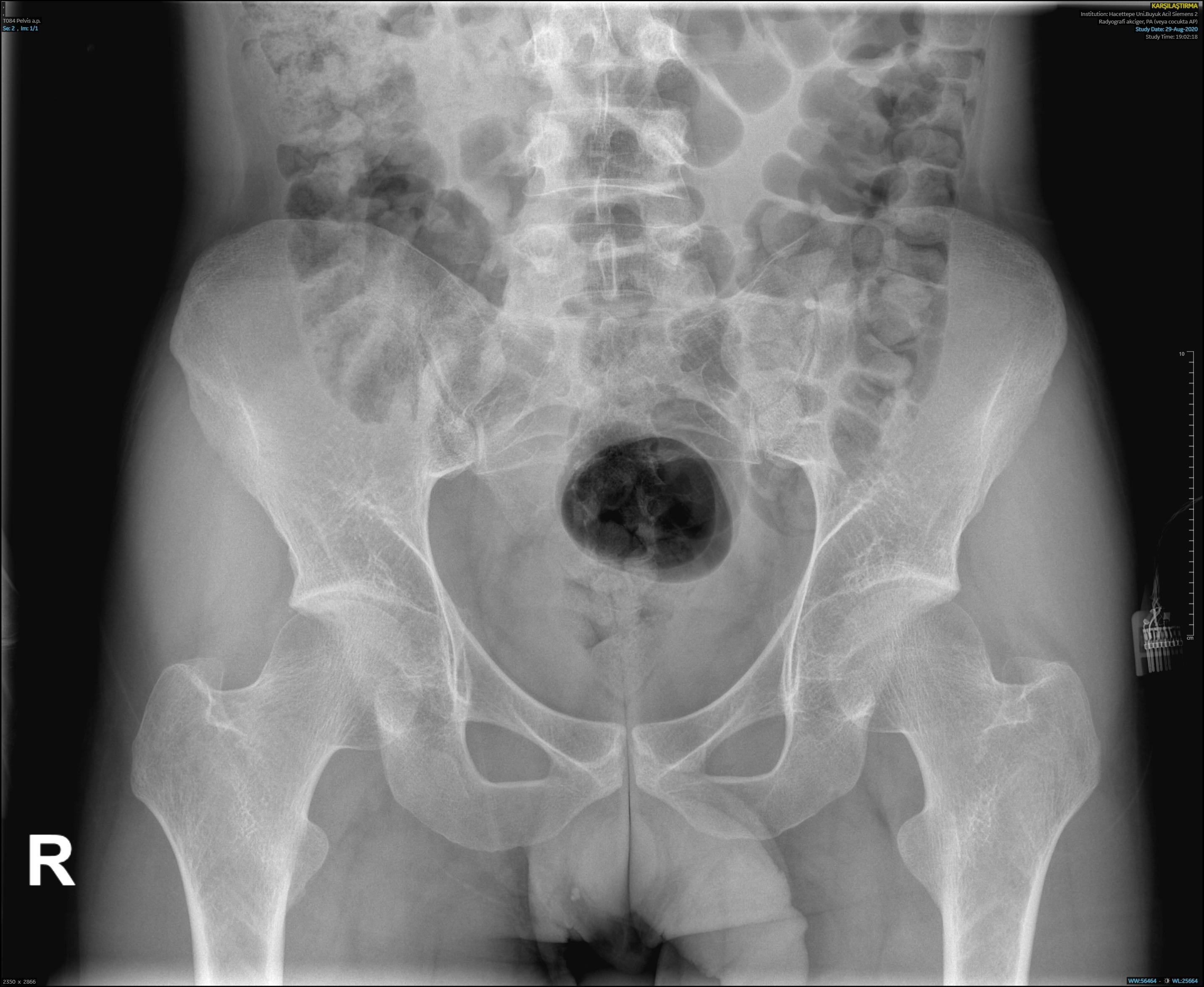 TEST-PELVIS Dataset by First