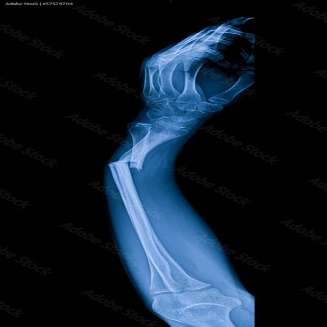 machine leanin - Roboflow Universe