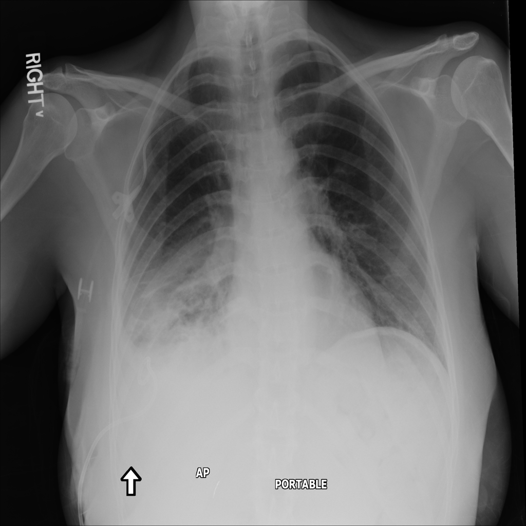 chest Object Detection Dataset by NJMU 4th Aff Hos