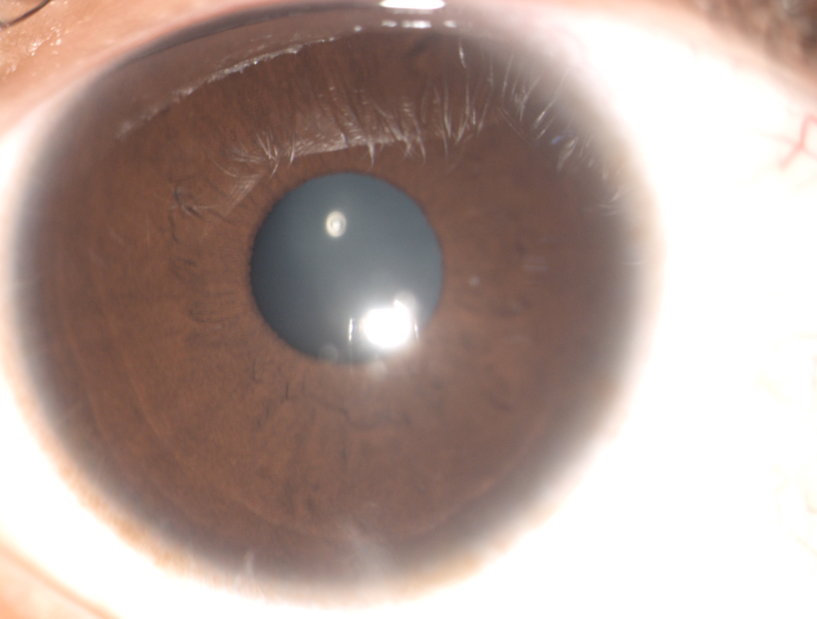 IrisPupilSegmentation Instance Segmentation Dataset and Pre-Trained Model by MyWorkSpace