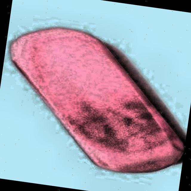 sdp-segmentation Instance Segmentation Dataset by YOLOcustom
