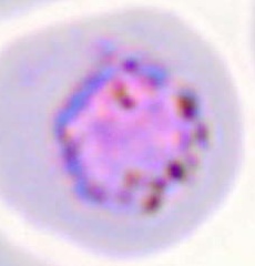 Knowlesi Detection Classification Model by Khang