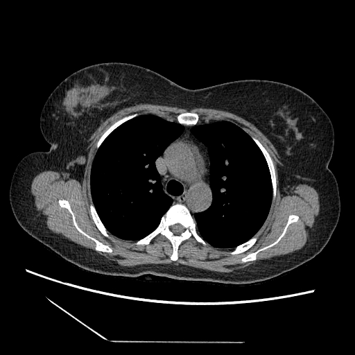 Cancer Detection Instance Segmentation Dataset By Zainab Pervaiz