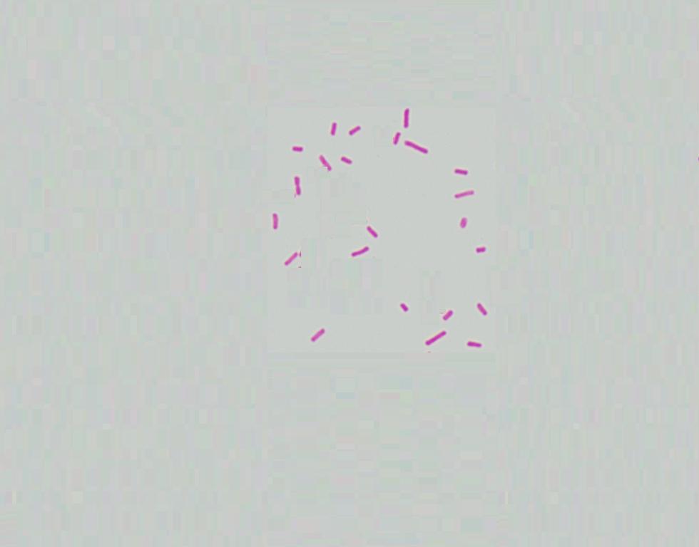 singleGNR Object Detection Dataset by Yeast