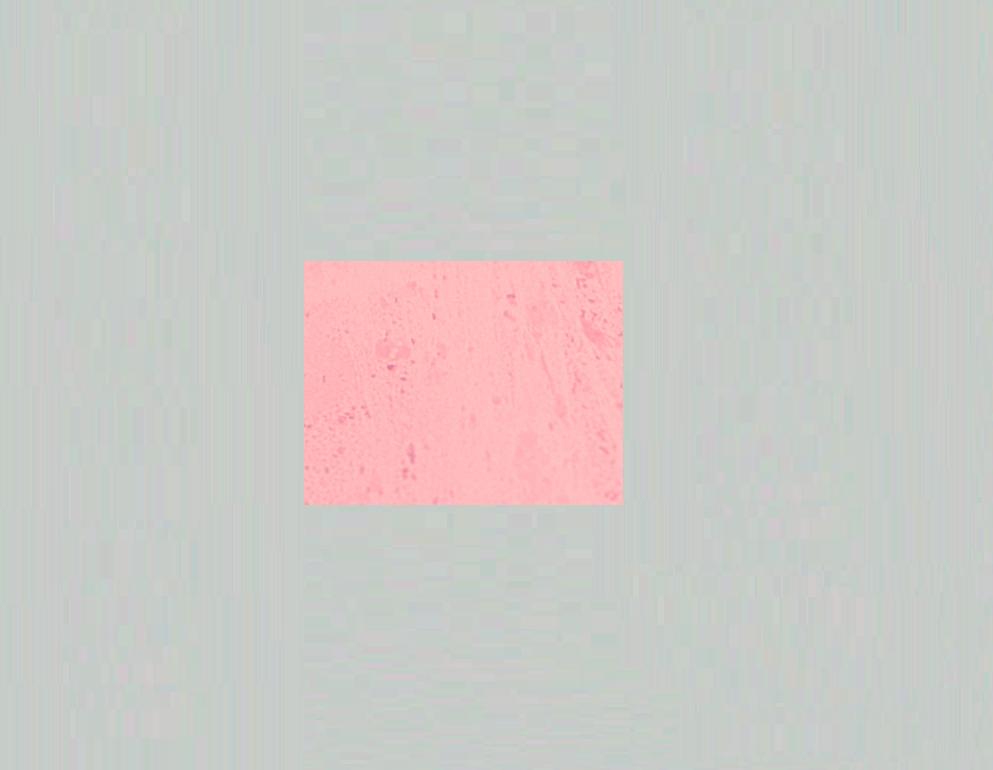 Haemophilus Object Detection Dataset by Yeast