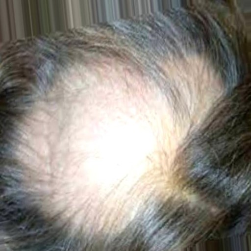 hair scalp analysis Object Detection Dataset by MVI