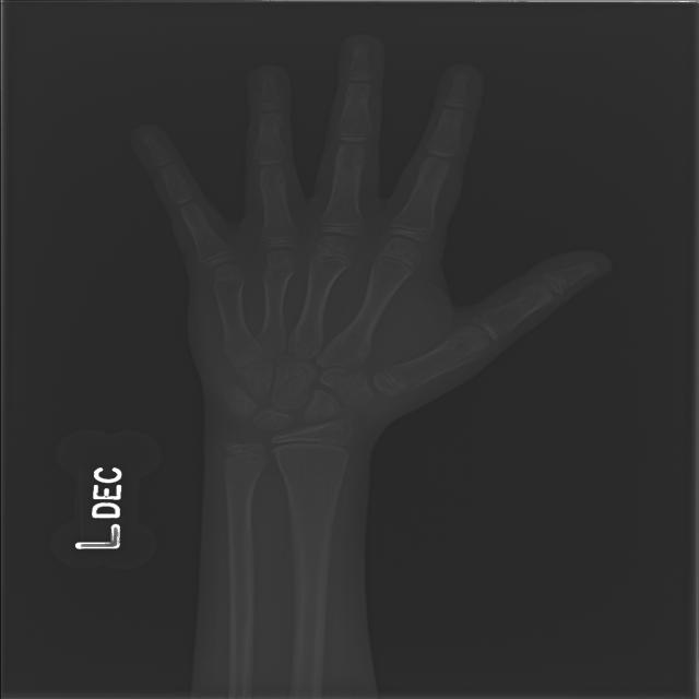 Xray Object Detection Dataset By Pavee Jeungtanasirikul Mingpv