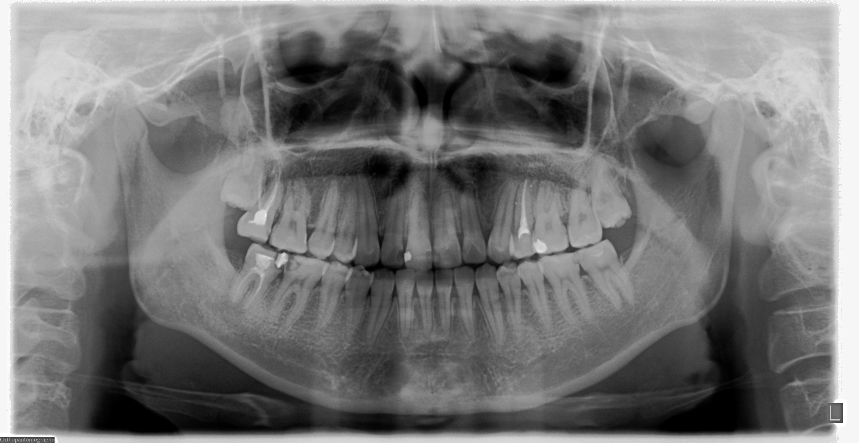 pp Instance Segmentation Dataset by Mohamed UOB
