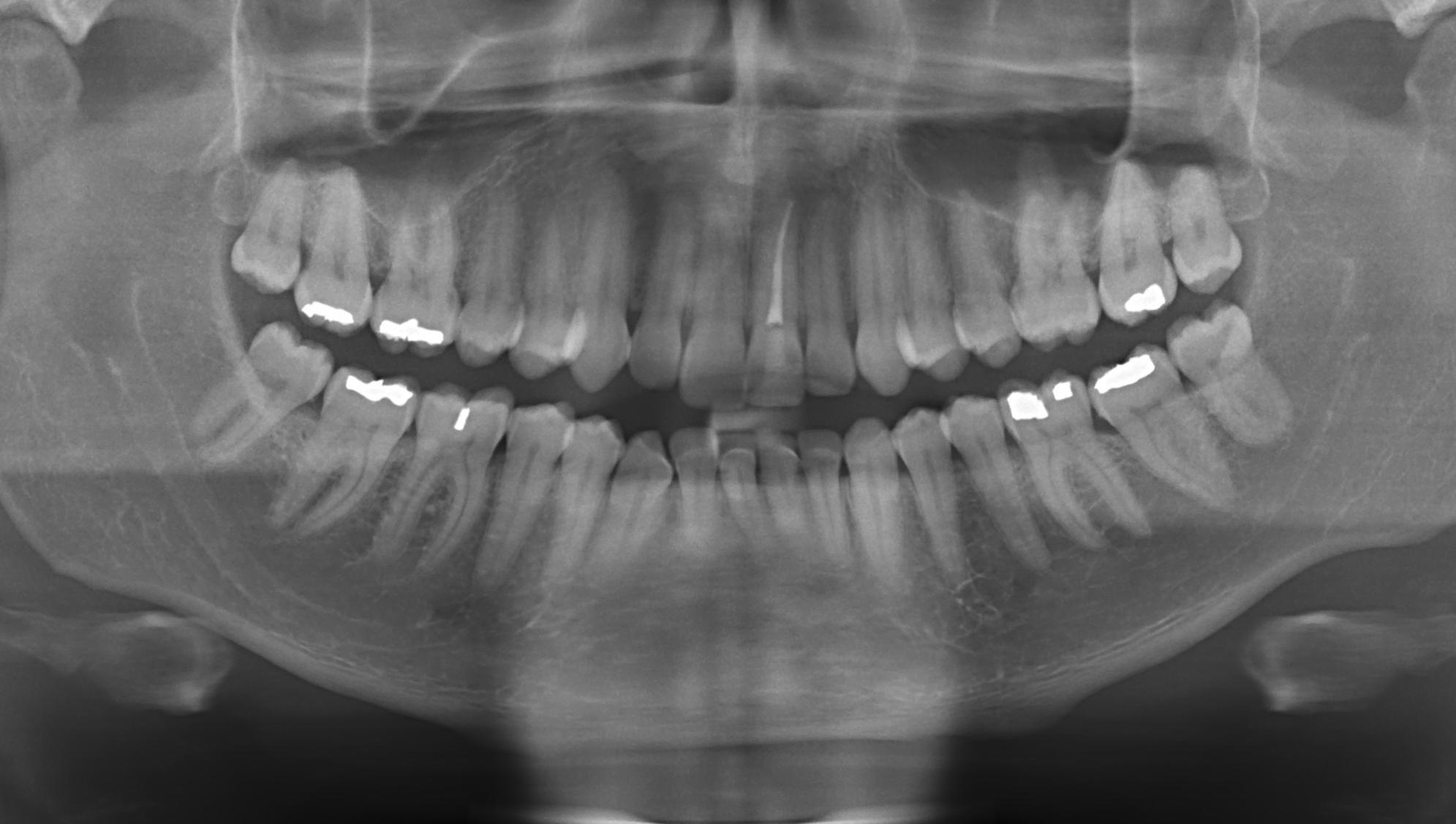 Final DI Instance Segmentation Model by Mohamed UOB