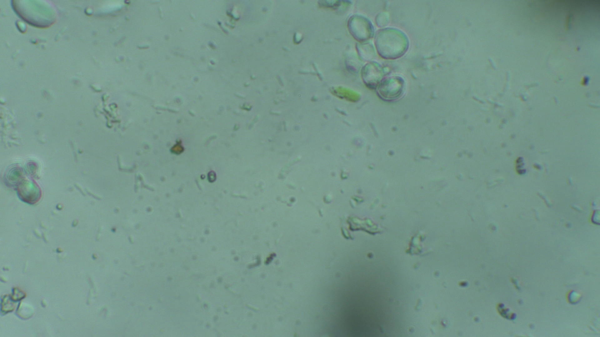 Algae Detection Object Detection Dataset And Pre Trained Model By Jk