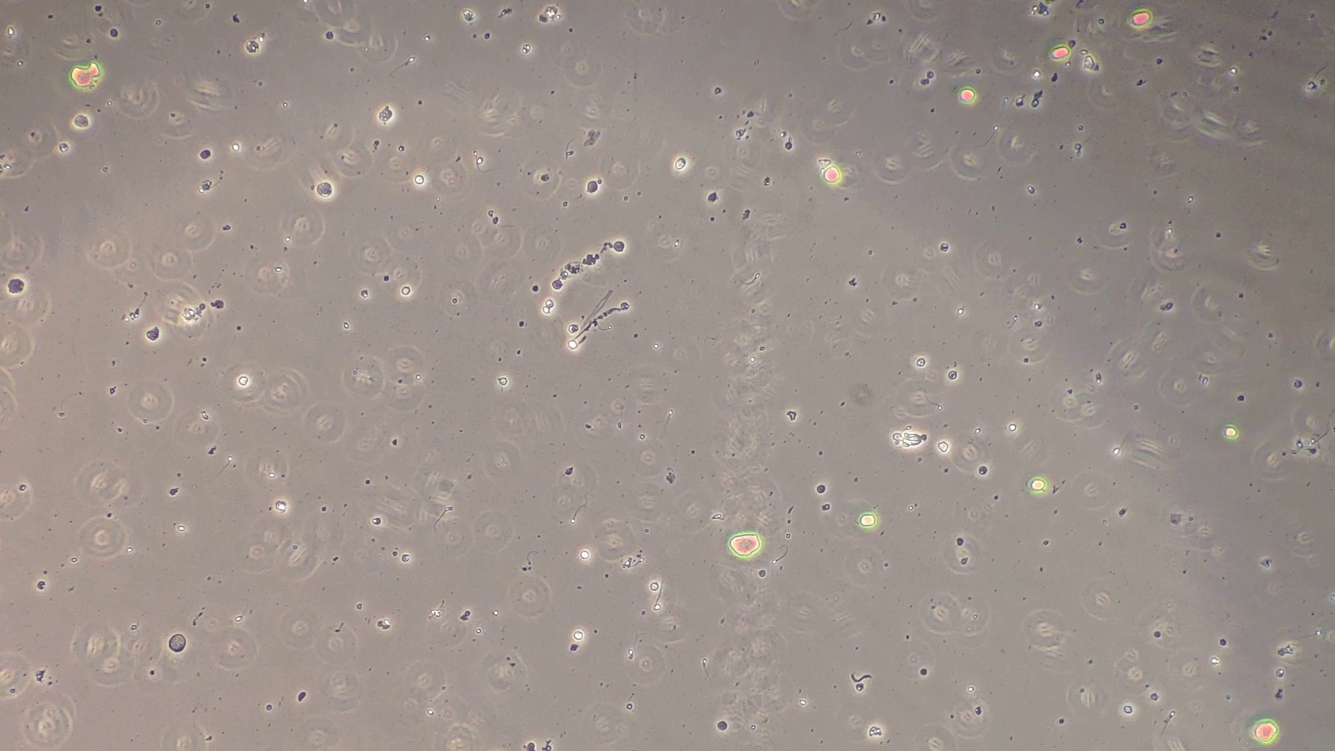 YoloV8_SDLV Object Detection Dataset and Pre-Trained Model by DetectronV3