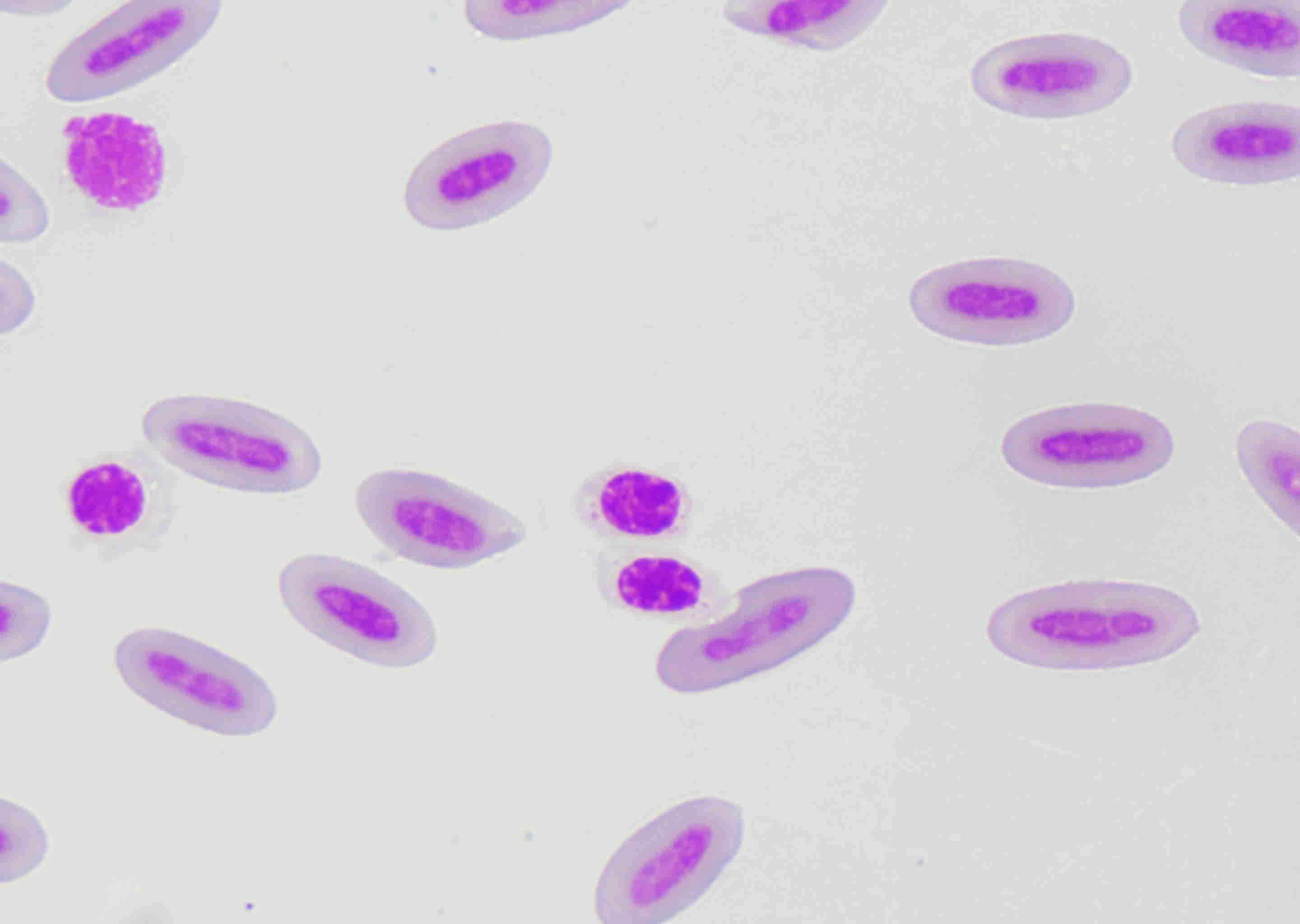 like:classification-of-white-blood-cells-in-hawks-qlve7/white-blood ...