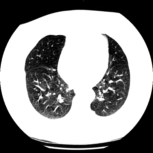 VTLC Object Detection Model (v1, 2023-12-29 3:39pm) by VTLC