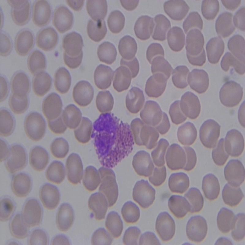 teste ai iph Object Detection Model by Ana Carolina