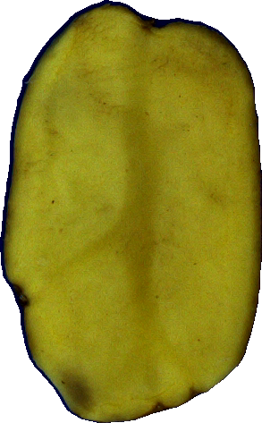 Potato Defect Detection - Roboflow Universe