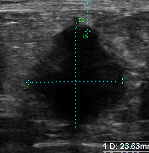 breast cancer Instance Segmentation Dataset and Pre-Trained Model by coba2