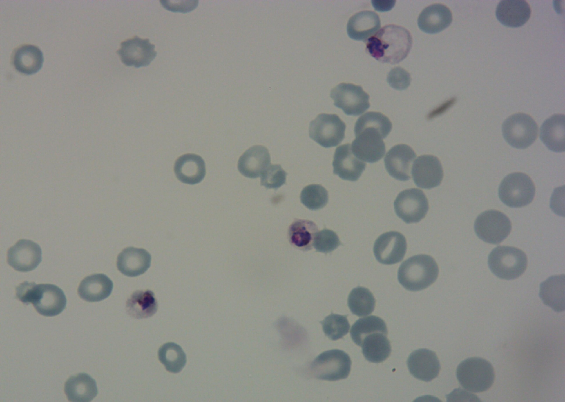 malaria_broadinstitute_diagmal Object Detection Model by MalariaSystem