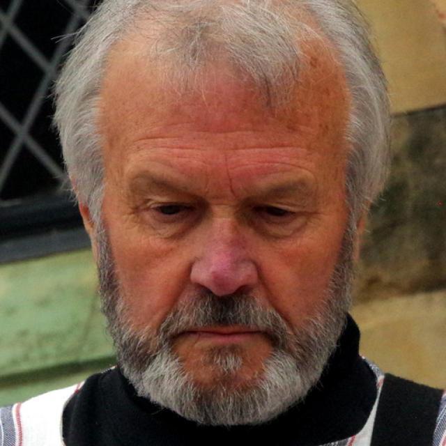 Dark Circles Object Detection Model V1 Dark Circles By Skin Condition Detection