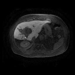 How to Use the Liver Tumor Instance Segmentation API