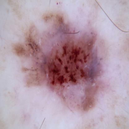 srec (srec-n4h4l) - Roboflow Universe